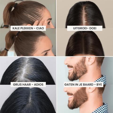 IMPERIO Uitgroeipoeder - morgen in huis